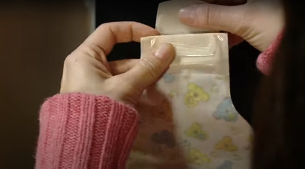 Stoma Care for Children and Their Families | Patient Education | UCSF ...