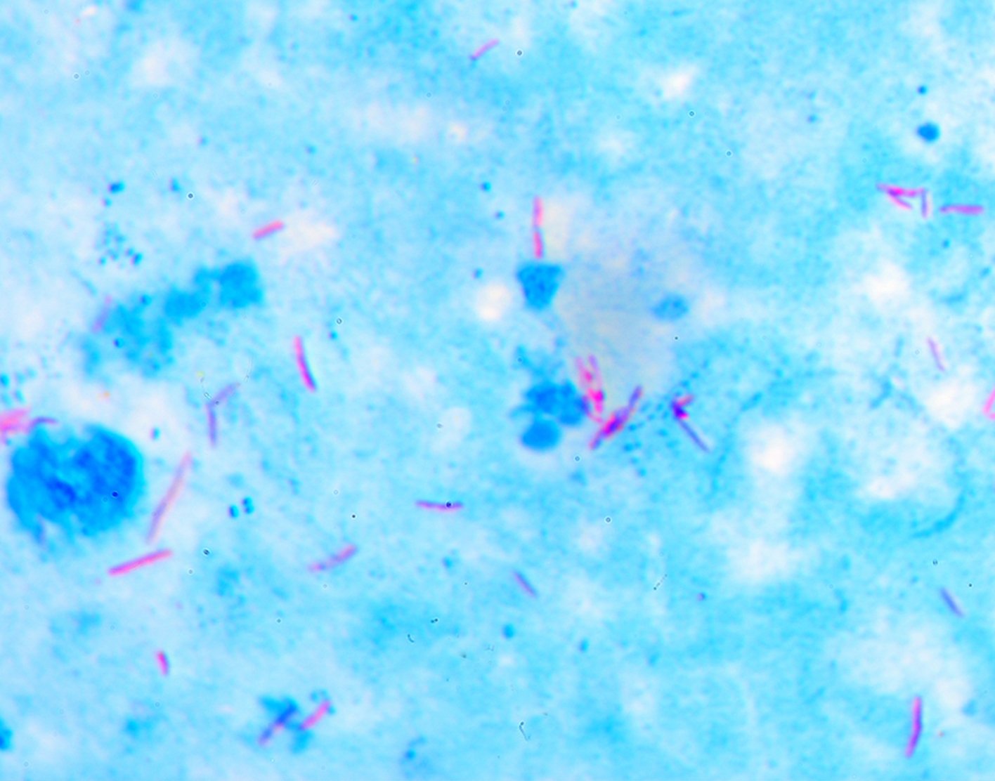 E Coli Acid Fast Stain Acid Fast Staining Principle, Procedure