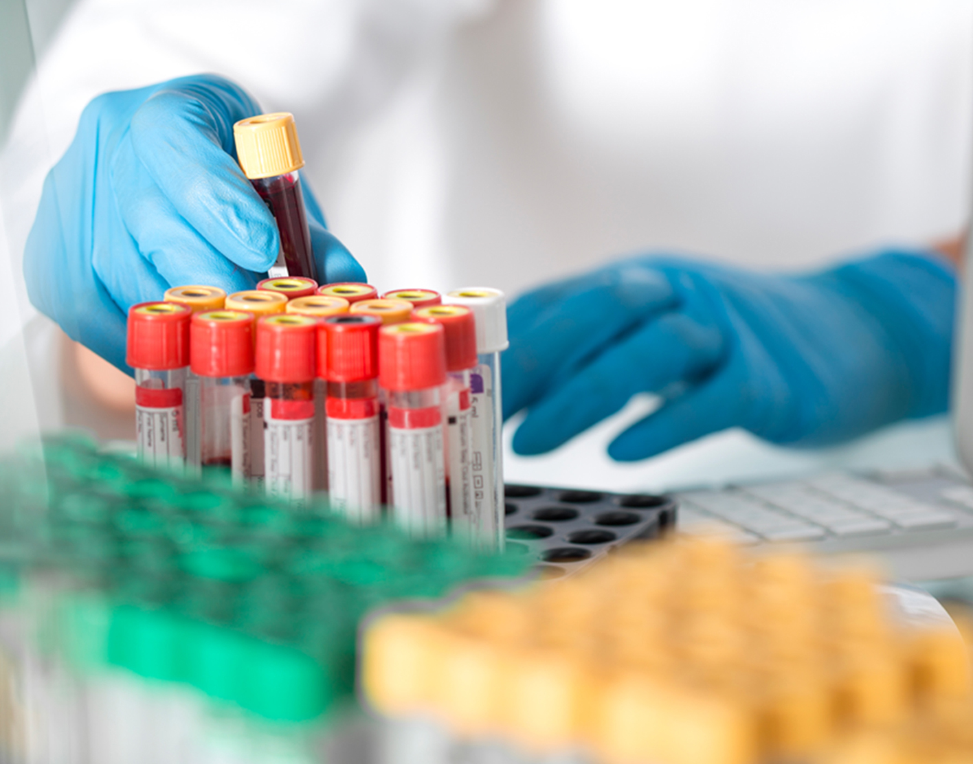 Acid loading test (pH)