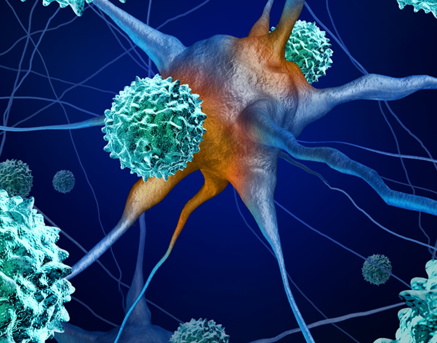 Acute flaccid myelitis
