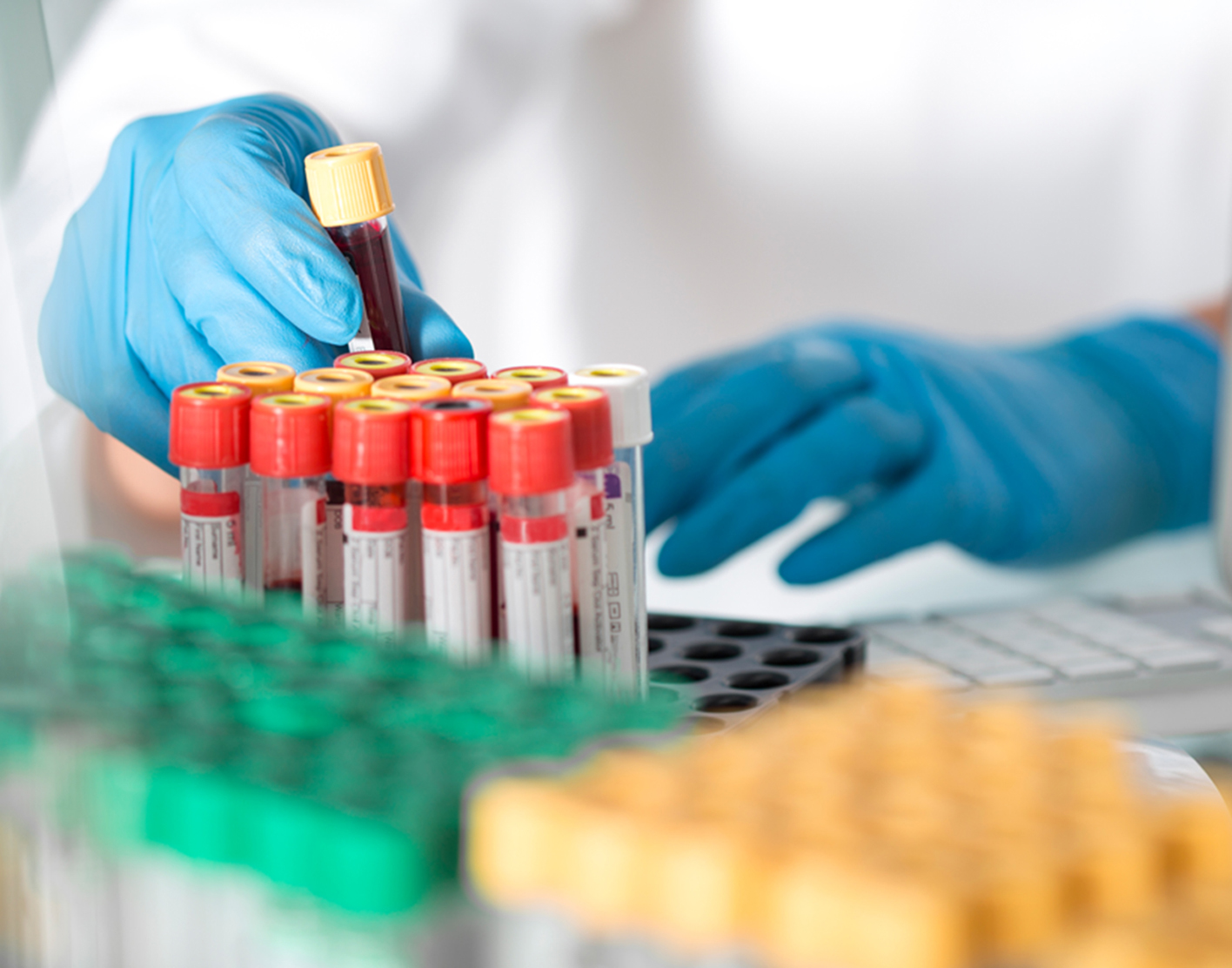 Alpha-1 antitrypsin blood test