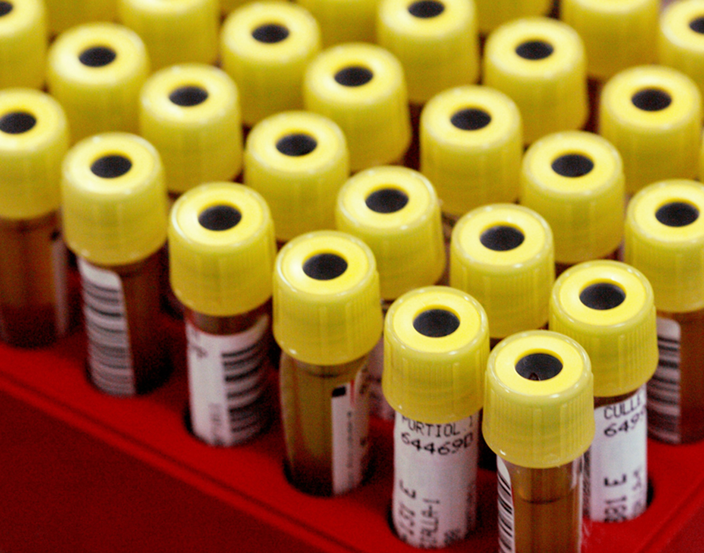 Apolipoprotein CII apolipoprotein-cii