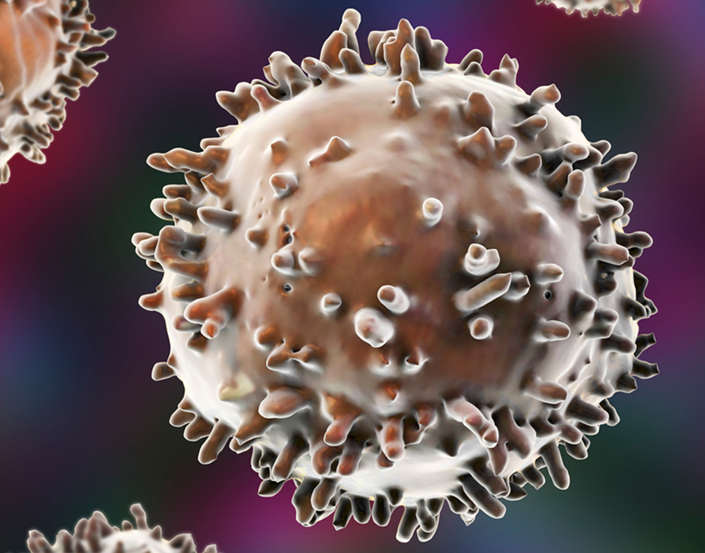 B-cell leukemia/lymphoma panel