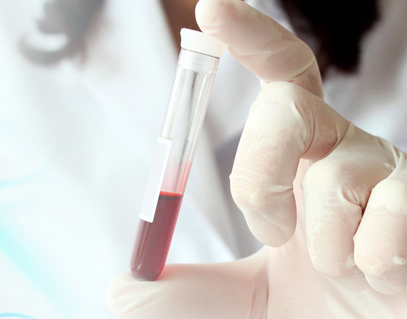 Basic metabolic panel