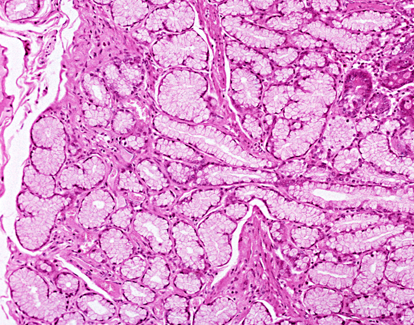 Biopsy - biliary tract