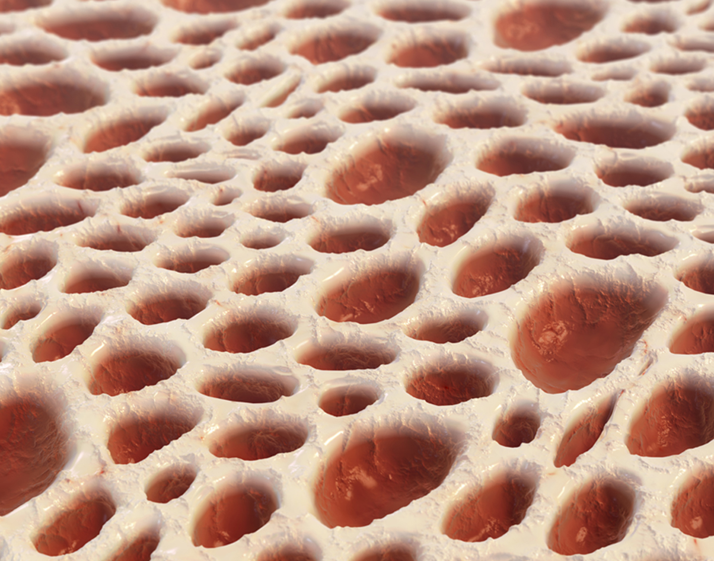 Bone marrow biopsy