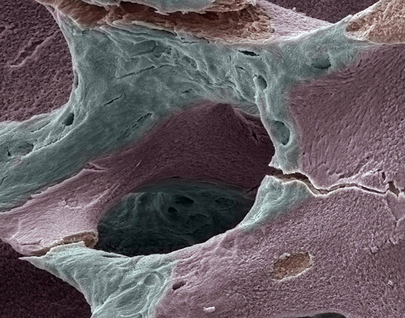 Bone mineral density test