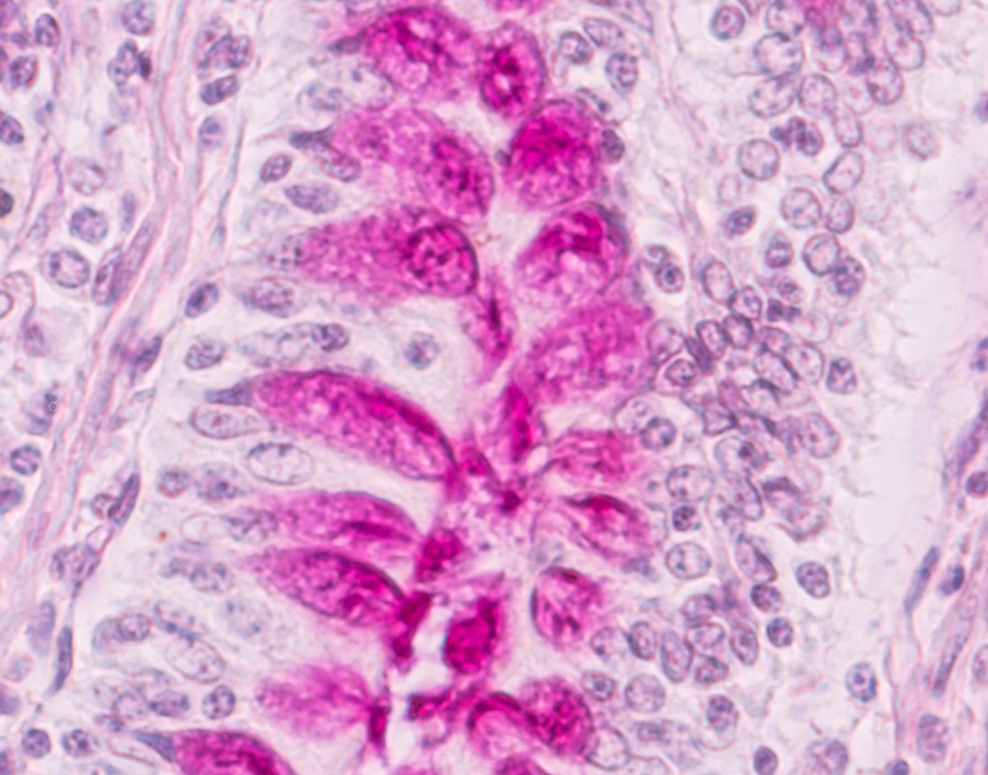 Culture - duodenal tissue