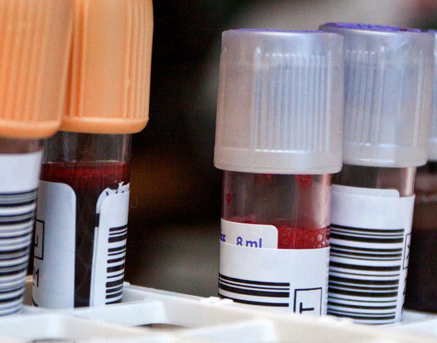 Estradiol blood test