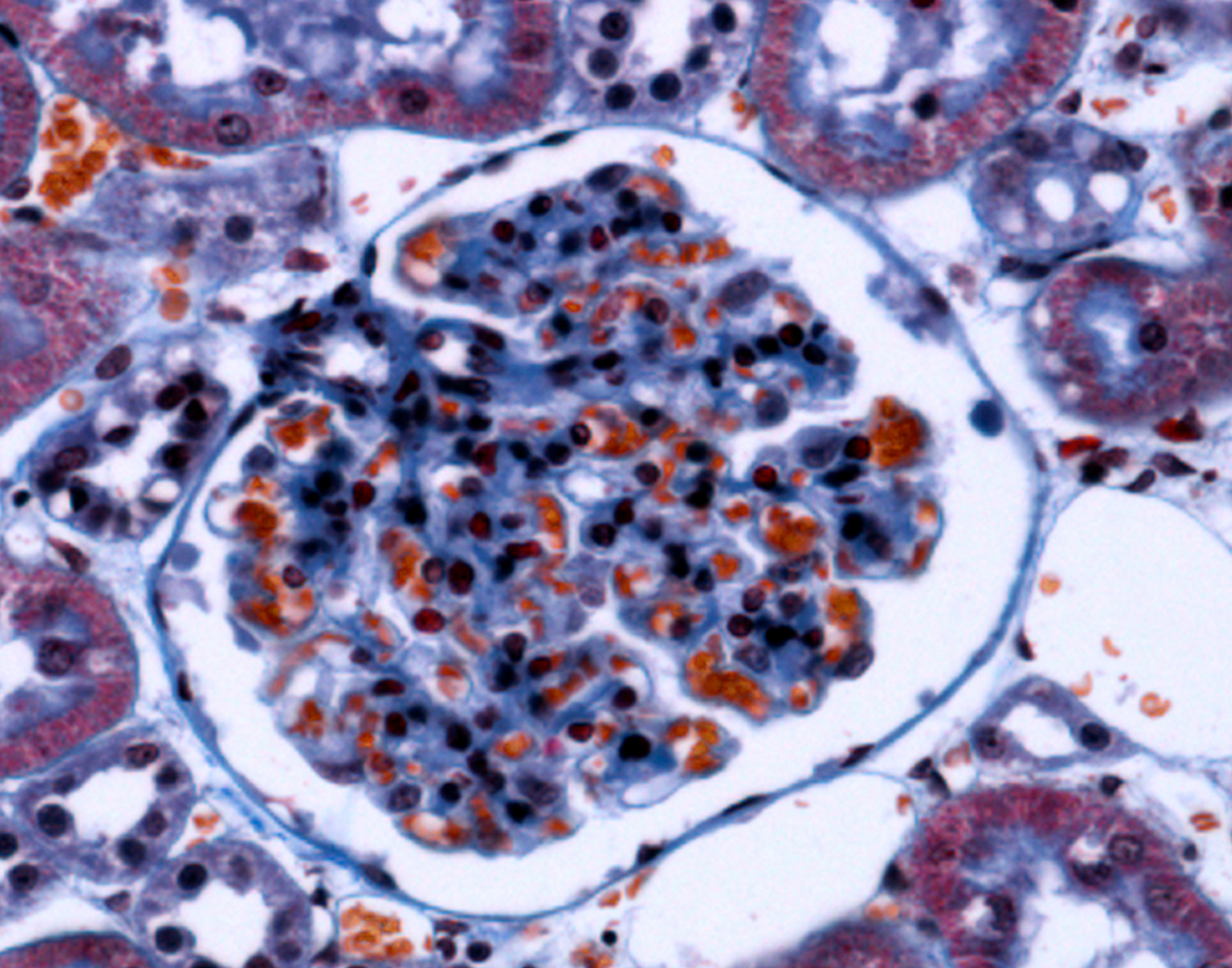 Glomerular filtration rate