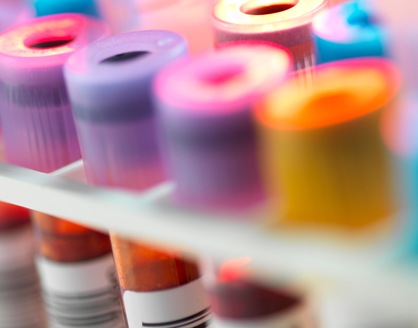 Haptoglobin blood test