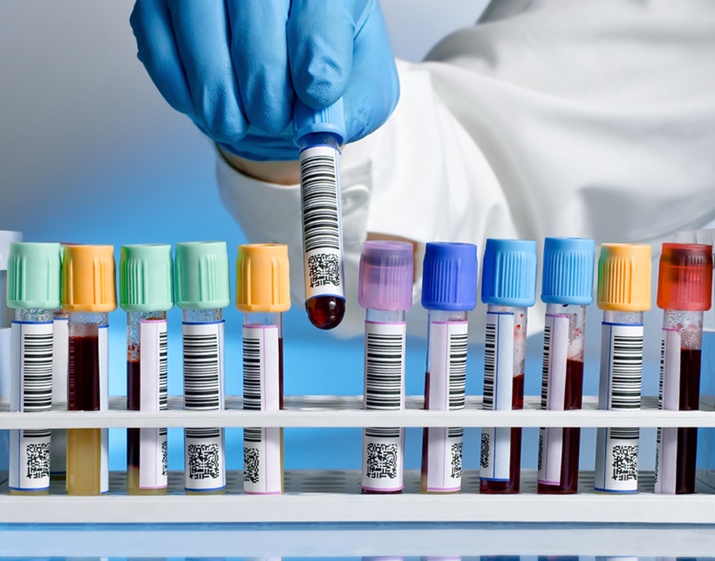 Lyme disease blood test