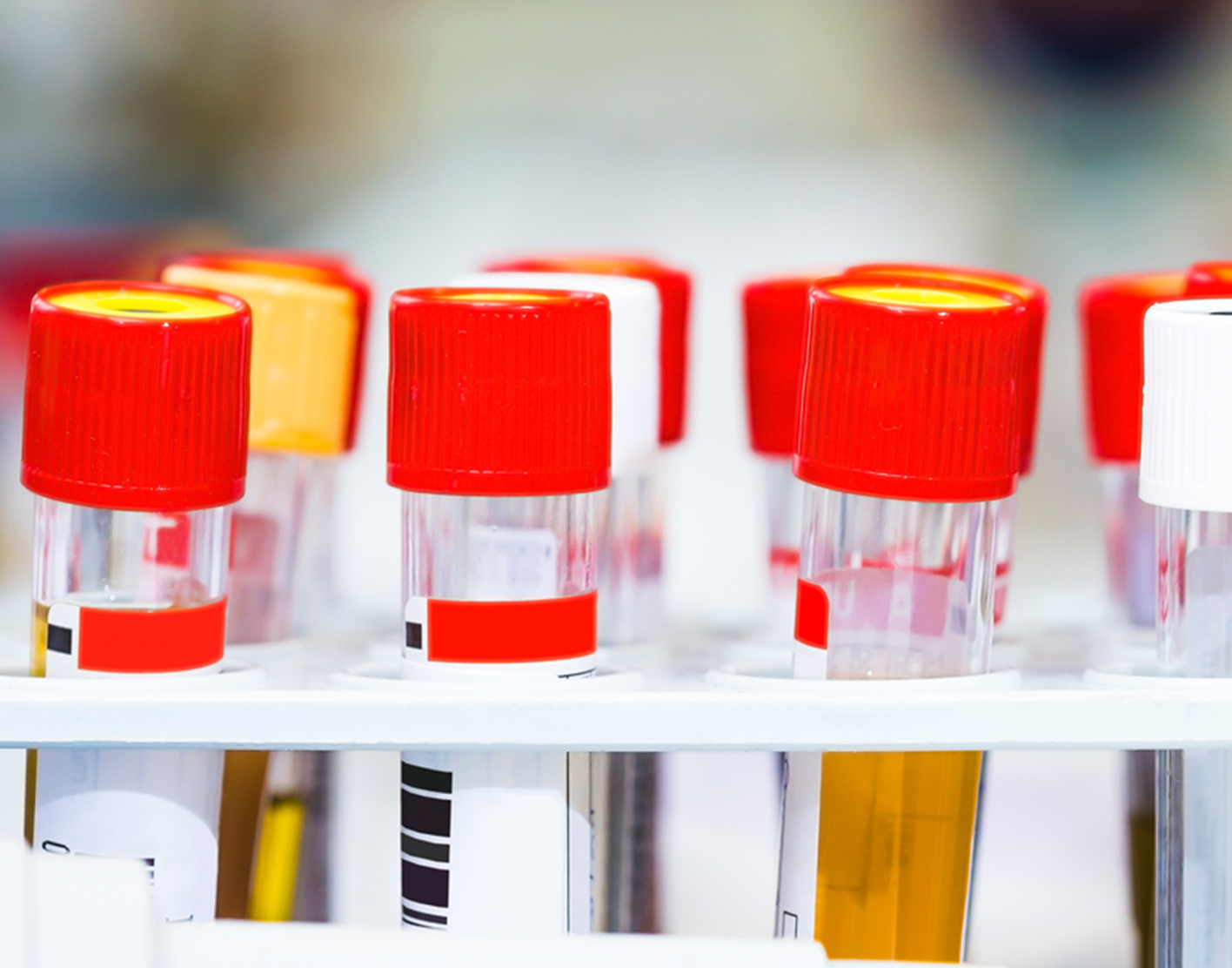 Potassium urine test