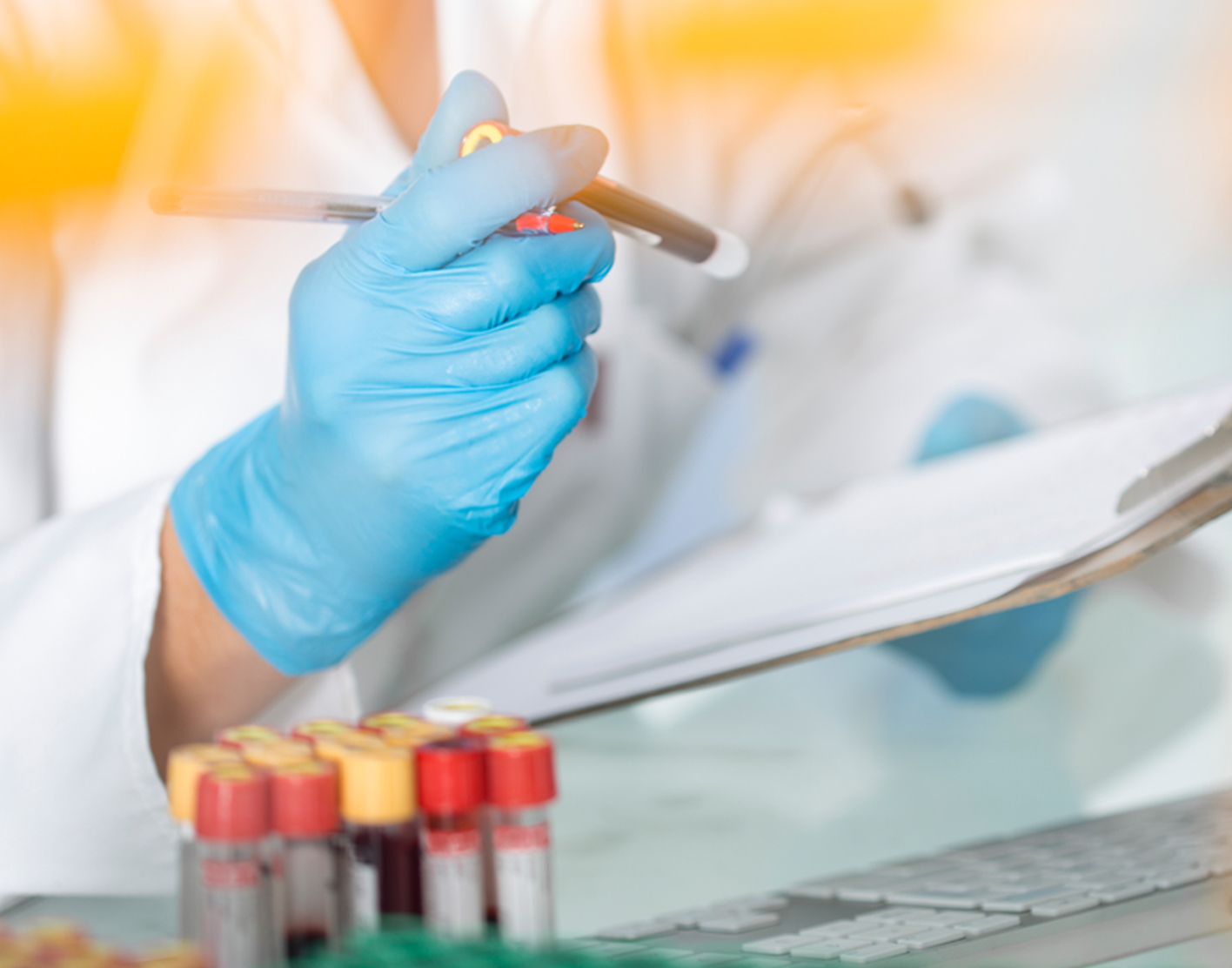 Protein C blood test