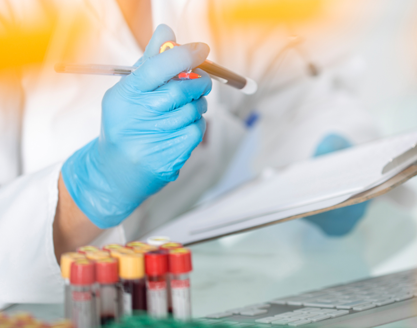 Pyruvate kinase blood test