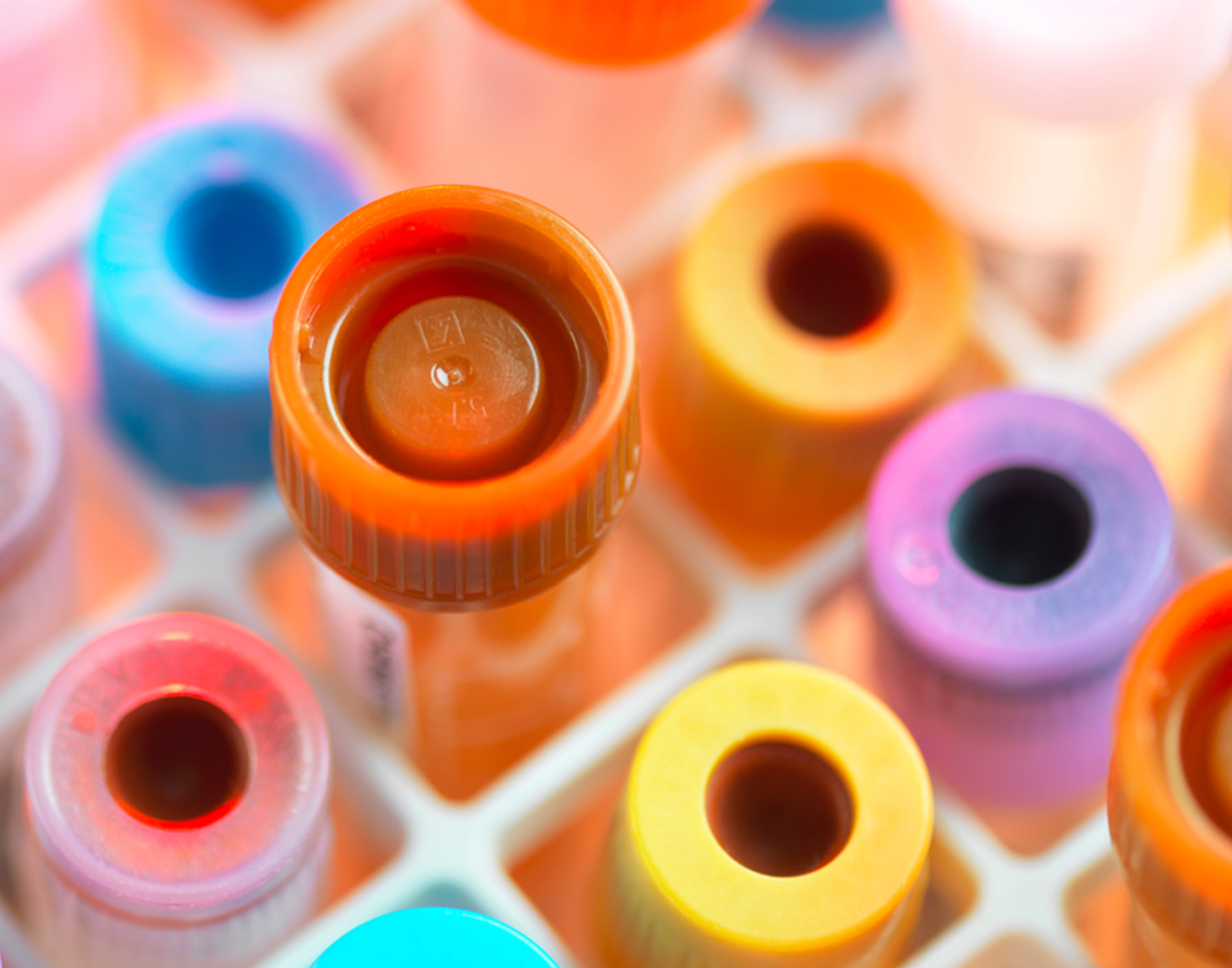 Serology for brucellosis