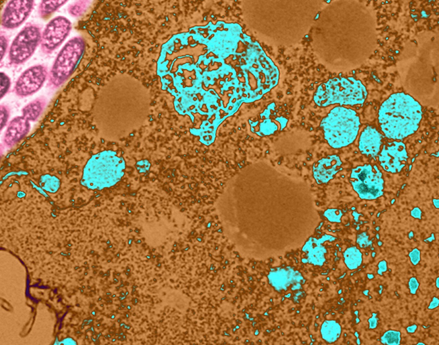 Sputum direct fluorescent antibody (DFA) test