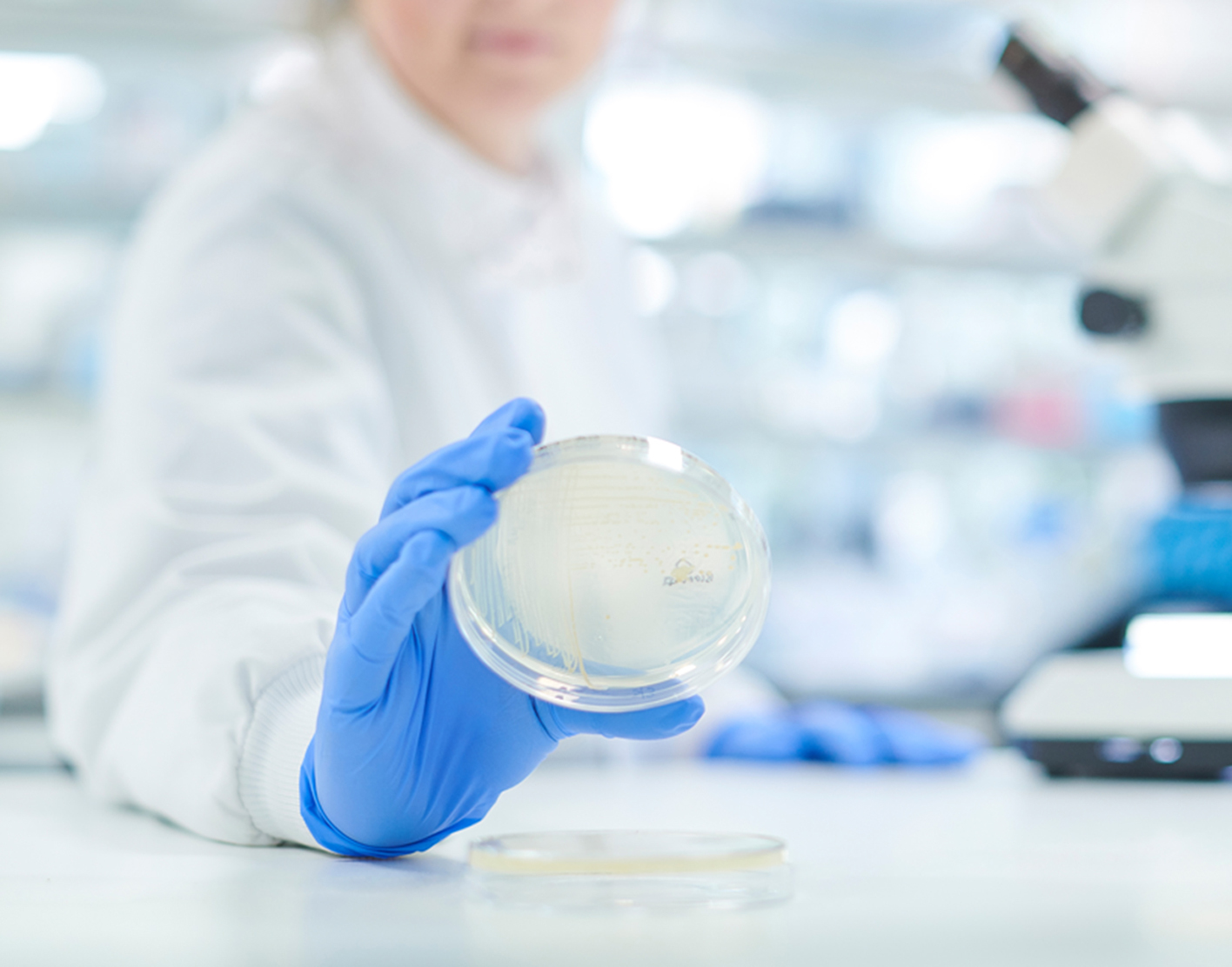 Stool C difficile toxin