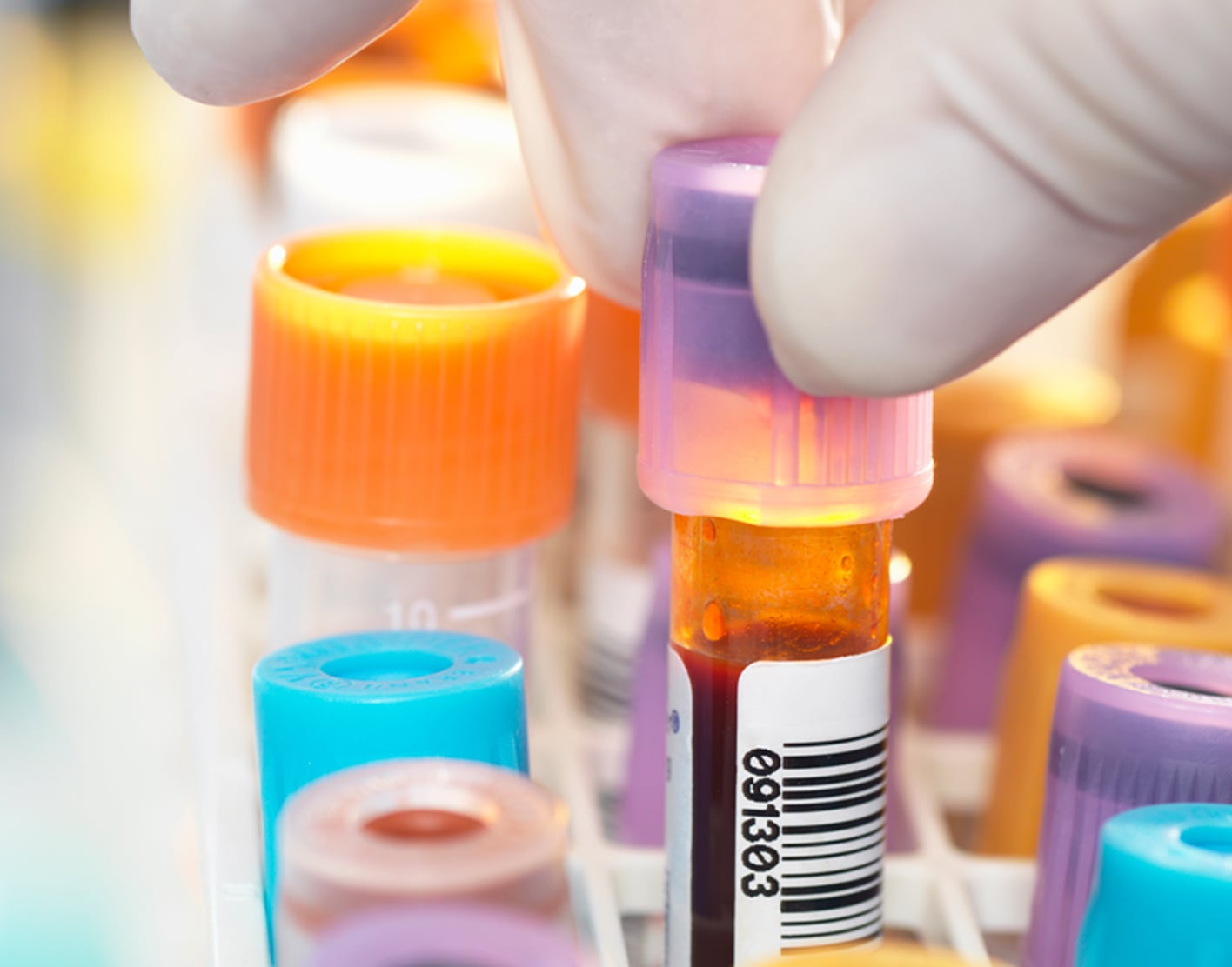 Tularemia blood test