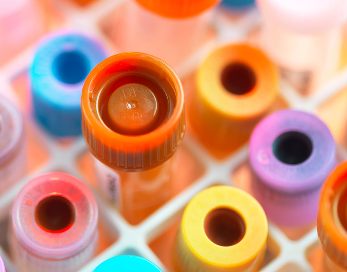 VLDL test