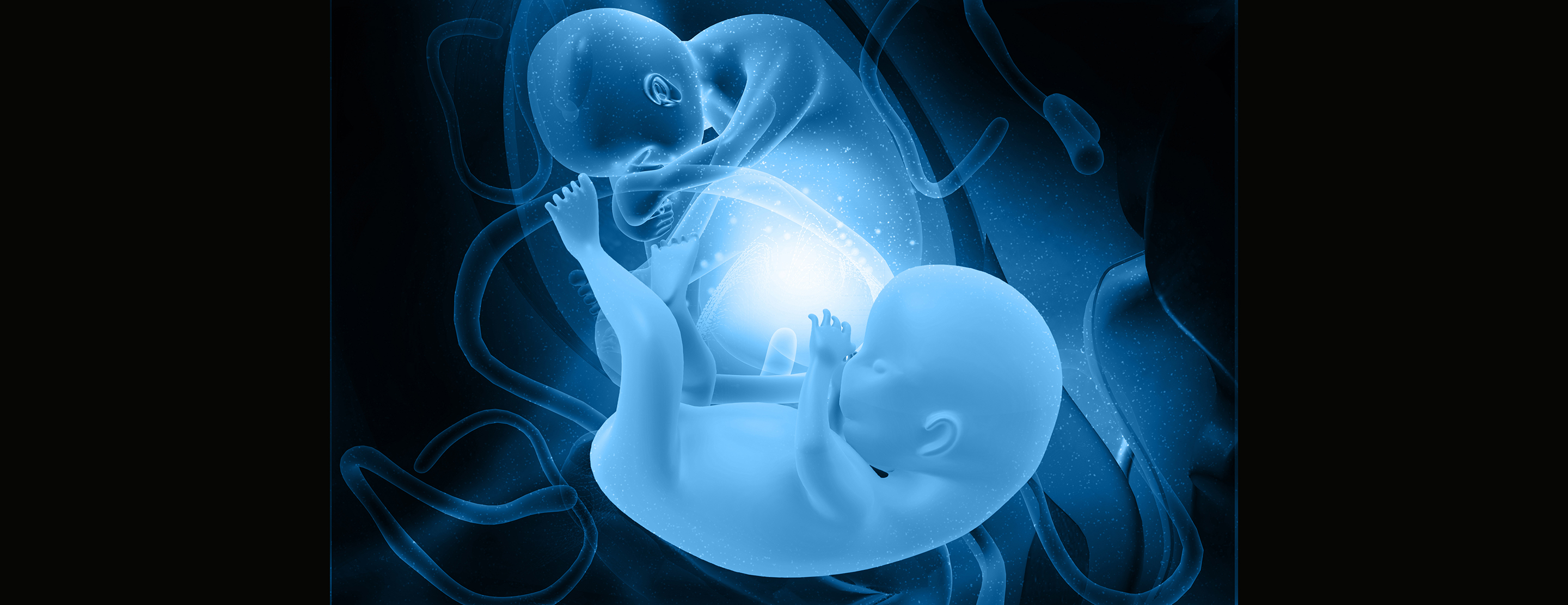 Fetal Surgery for Twin-to-Twin Transfusion Syndrome | Patient Stories ...