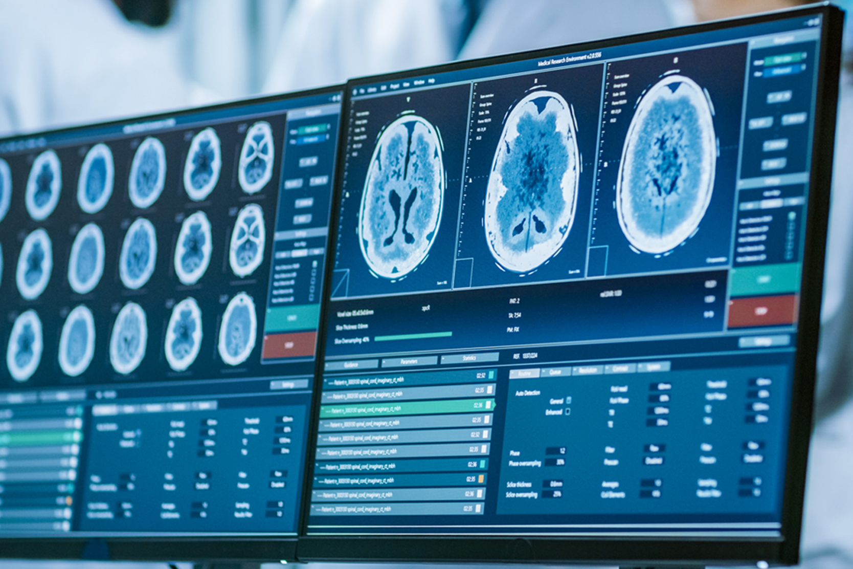 Brain Mapping | UCSF Benioff Children's Hospitals